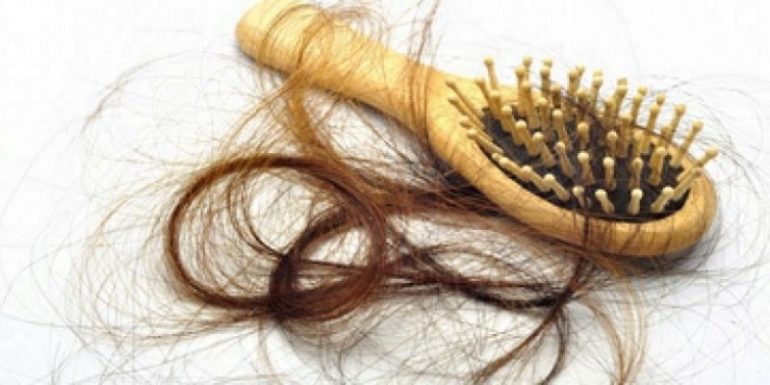 Voici les aliments à privilégier pour prévenir la perte de cheveux - L-FRII Voici les aliments à privilégier pour prévenir la perte de cheveux - L-FRII